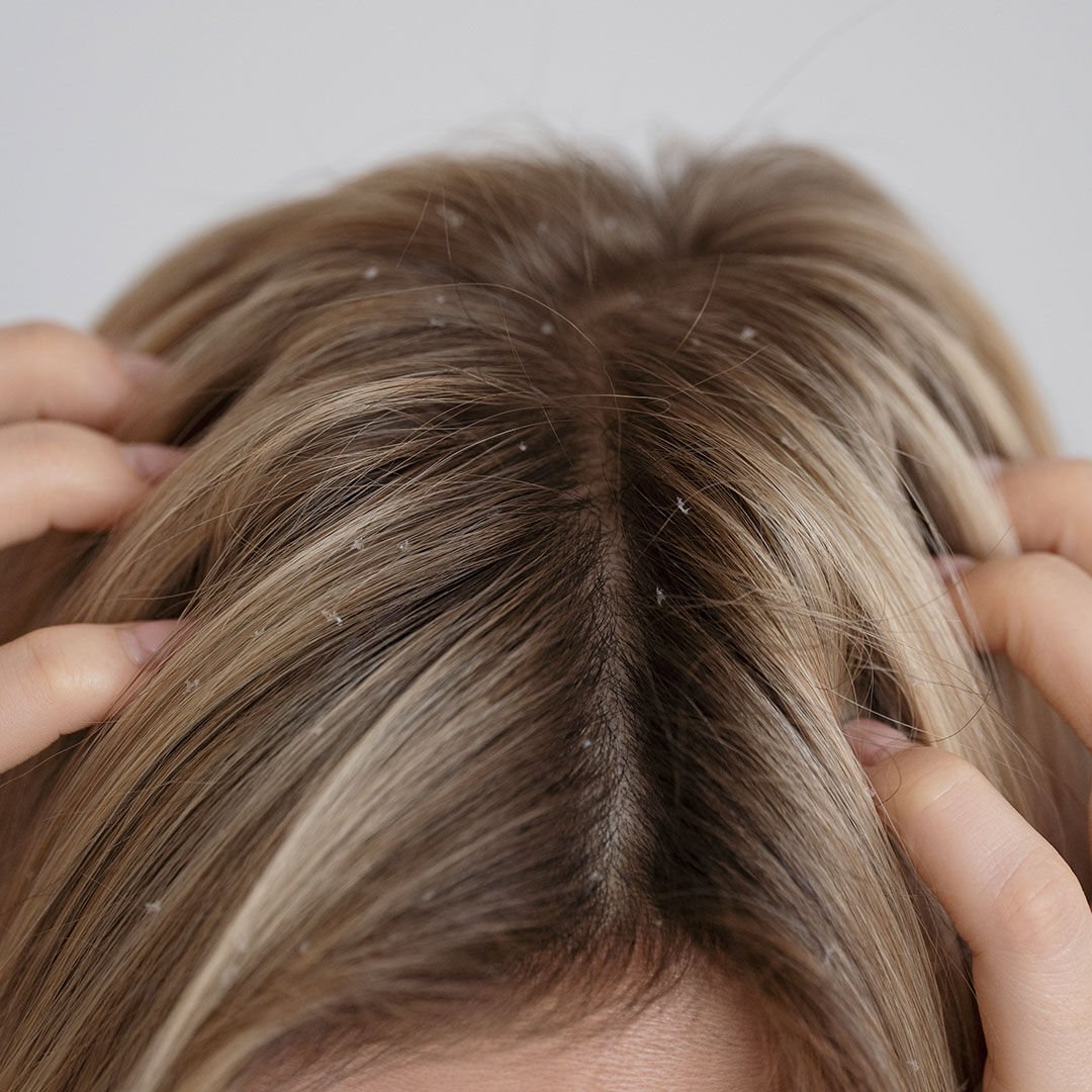 Prendre soin de son cuir chevelu