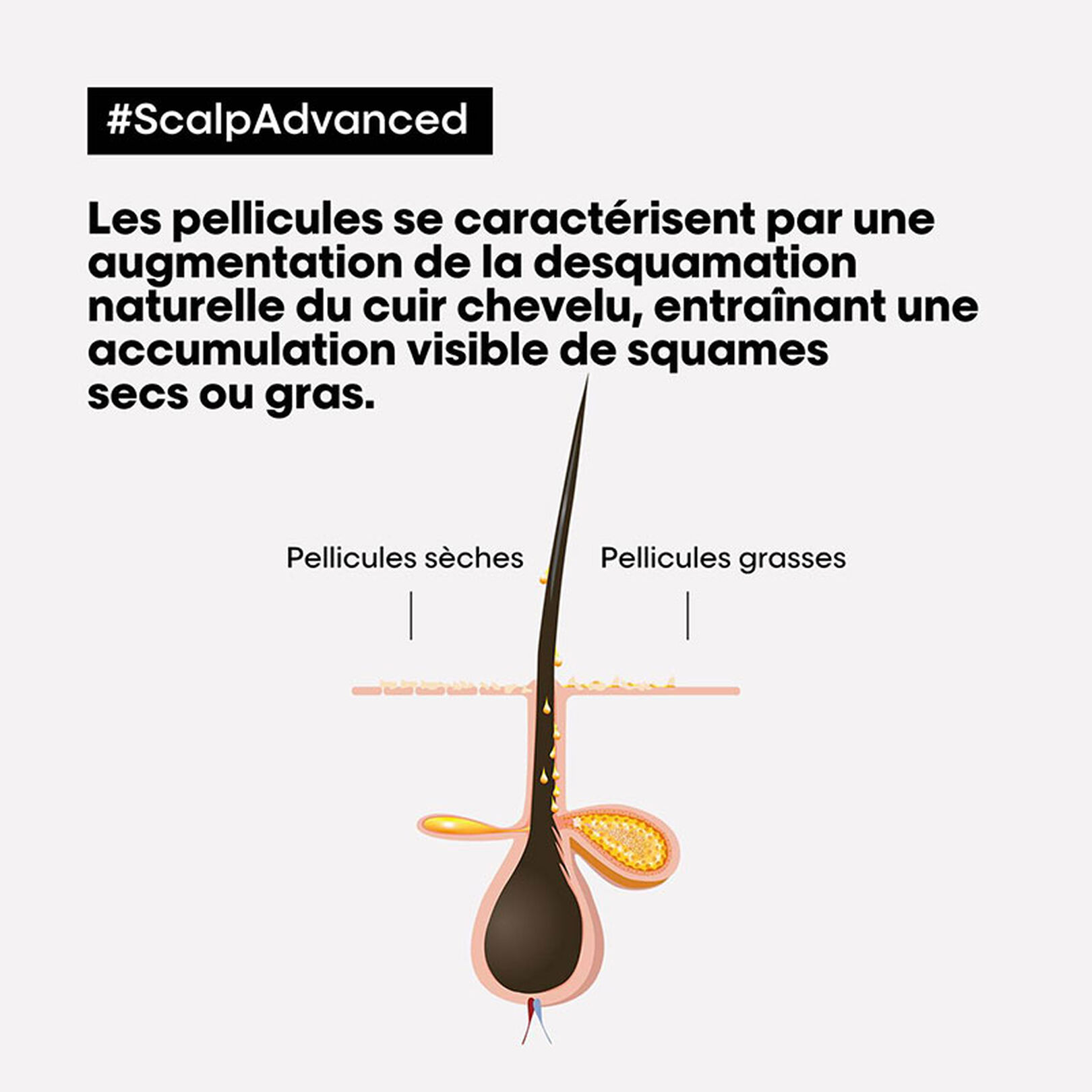 Routine anti-pellicules grasses Scalp Advanced | laboutiqueducoiffeur.com